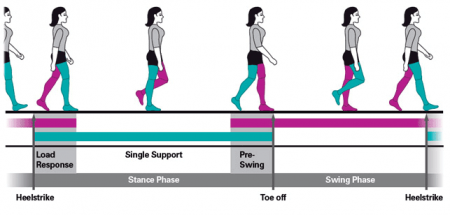Gait Analysis - Foot Pain Centres of Leeds