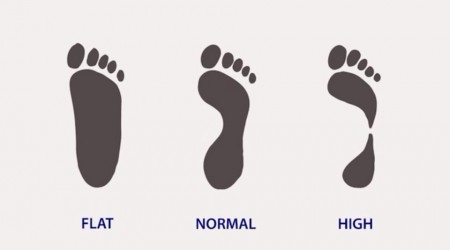 What is Pronation? - Foot Pain Centres of Leeds